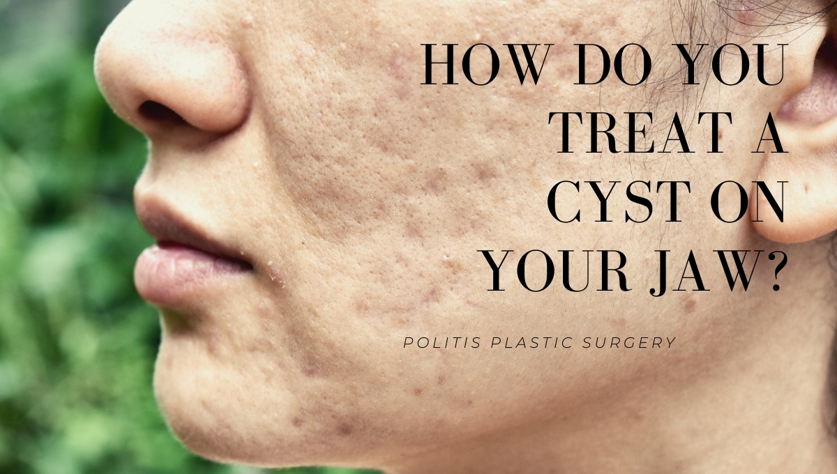 How do you treat a cyst on your jaw? | Politis Plastic Surgery | Tampa ...